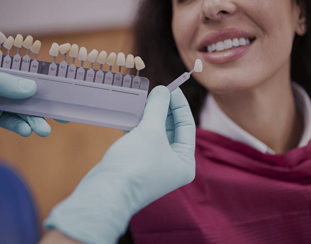 How To Choose The Proper Crown Color in 2023 – NatruSmile