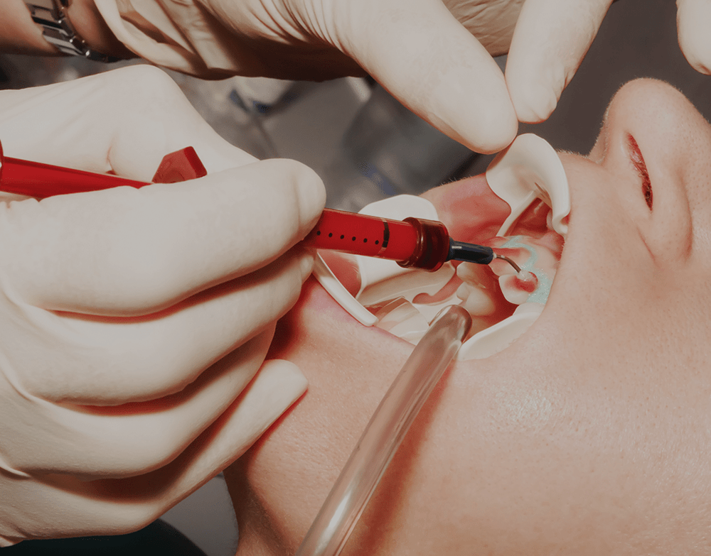 A Guide To Hydrogen Peroxide For Oral Health – NatruSmile