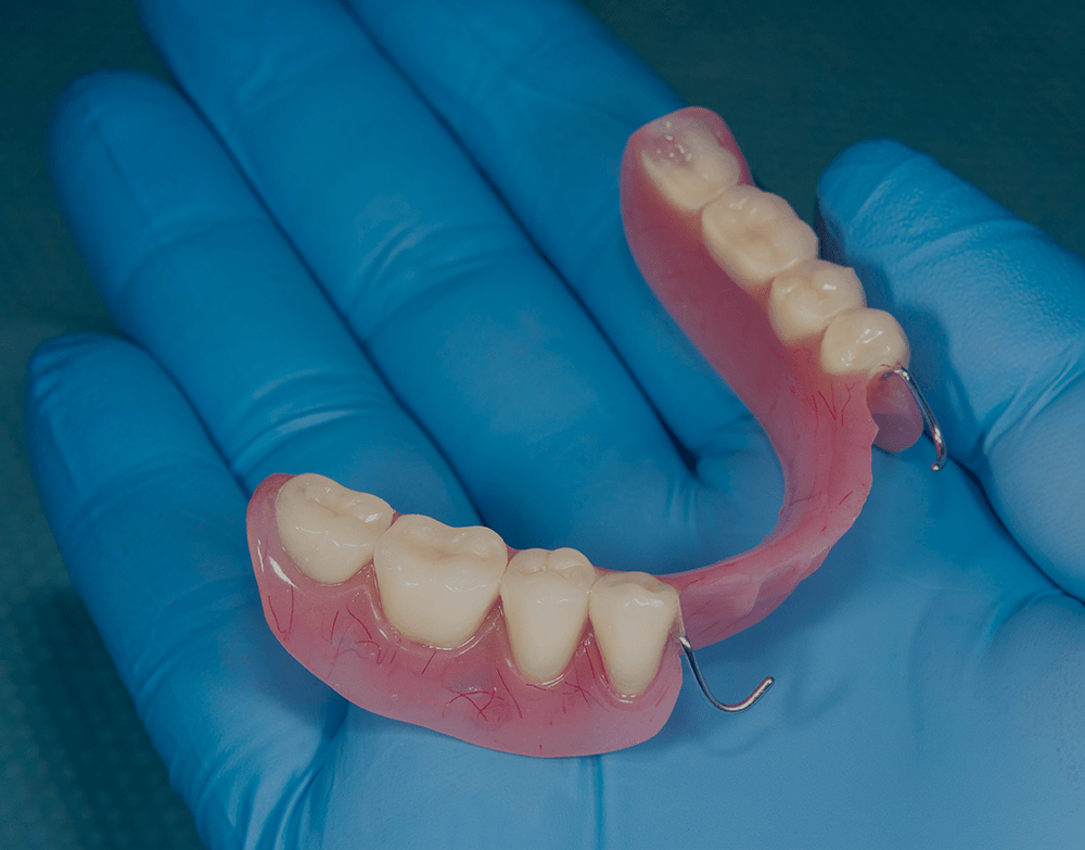 Removable Dental Bridge (2023 Guide) – NatruSmile