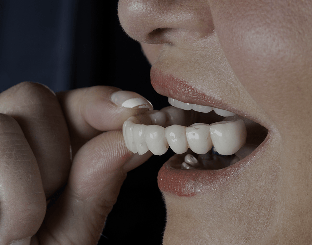 Temporary Dentures: Timeline, Costs, Benefits, And More – NatruSmile