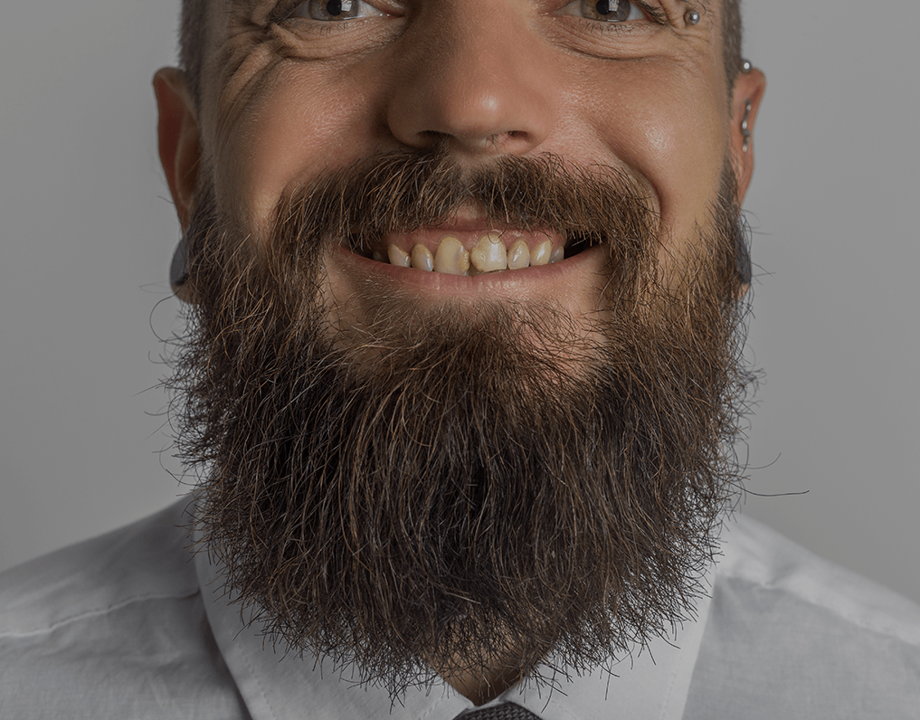 Grey Teeth: Diagnosis, Causes, And Treatment – NatruSmile