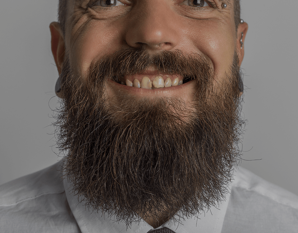 Grey Teeth: Diagnosis, Causes, And Treatment – NatruSmile